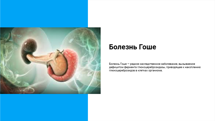 [Презентация] Болезнь Гоше